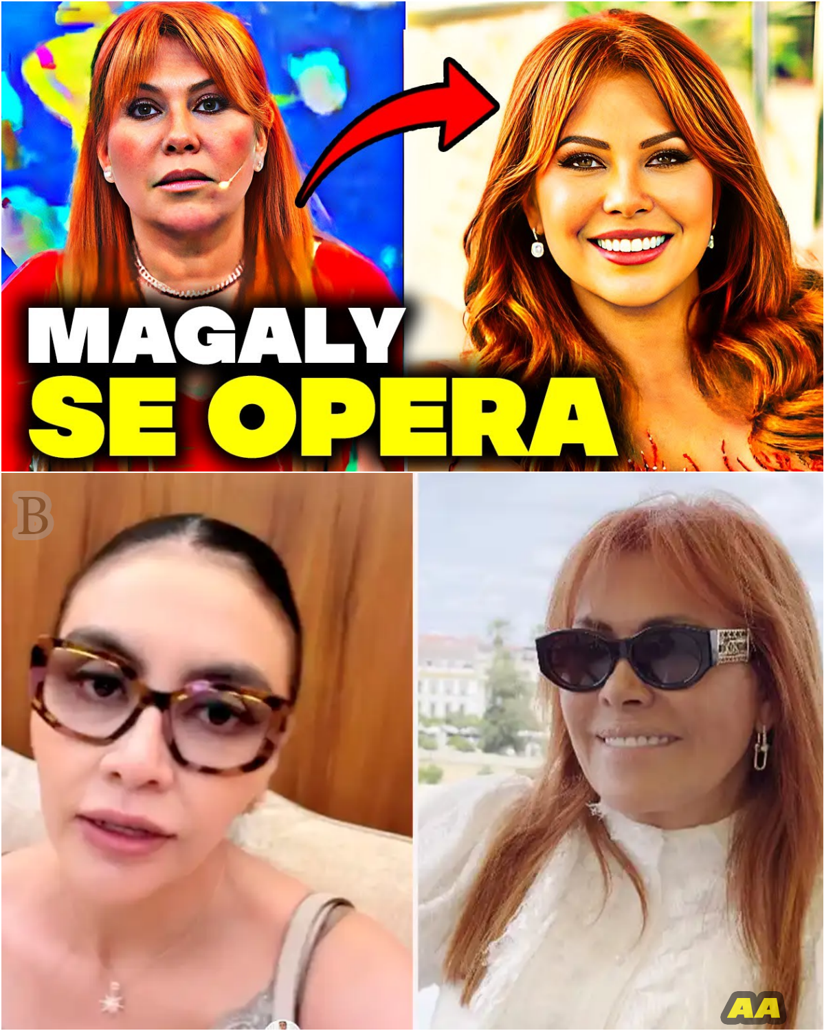 🔥📺 “No me voy a esconder”: Magaly Medina revela que se sometió a un ...